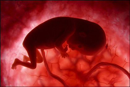 Passionate for Pre-born Babies | Diane Constantine